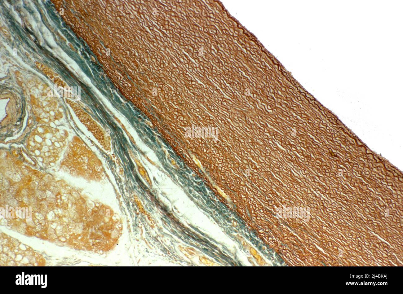 Elastic artery, light micrograph Stock Photo - Alamy