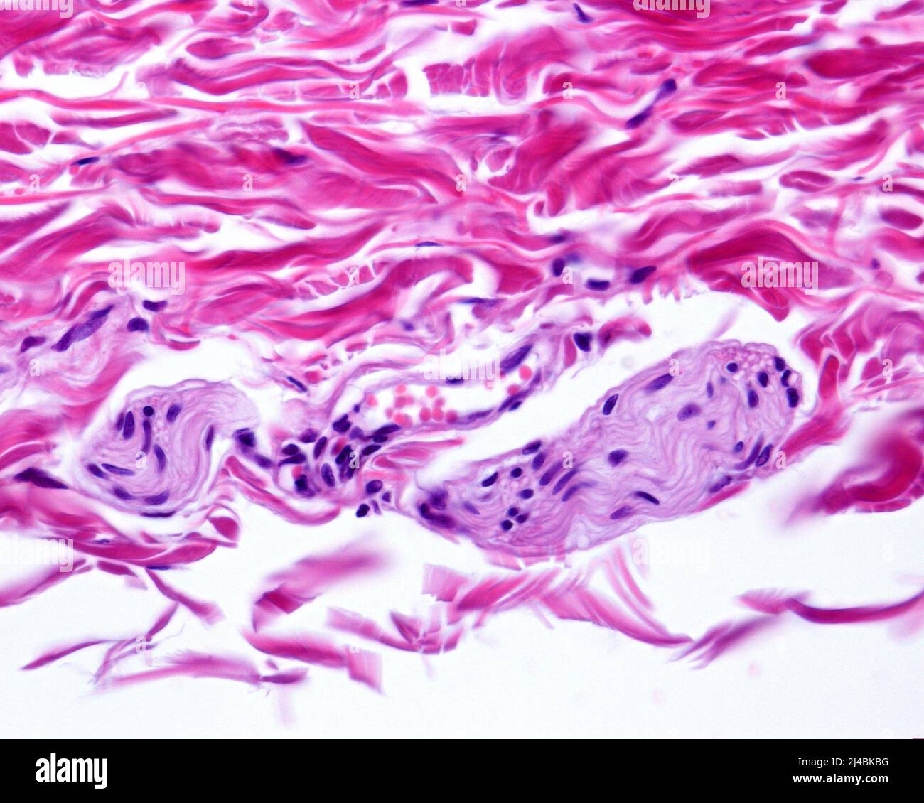 Vein adventitia, light micrograph Stock Photo - Alamy