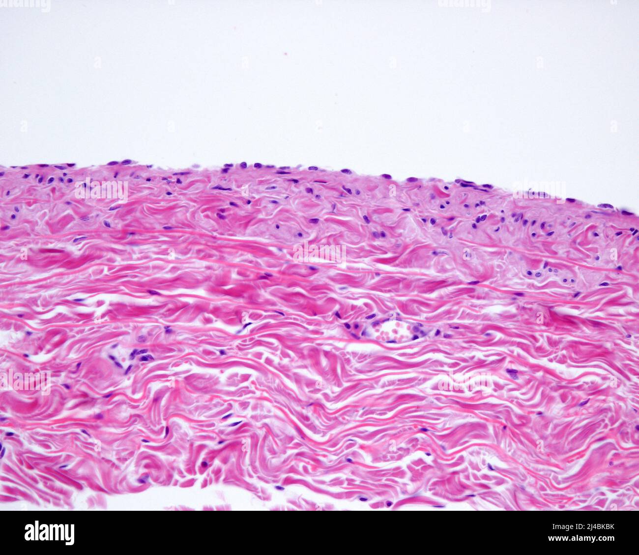 Large vein wall, light micrograph Stock Photo - Alamy