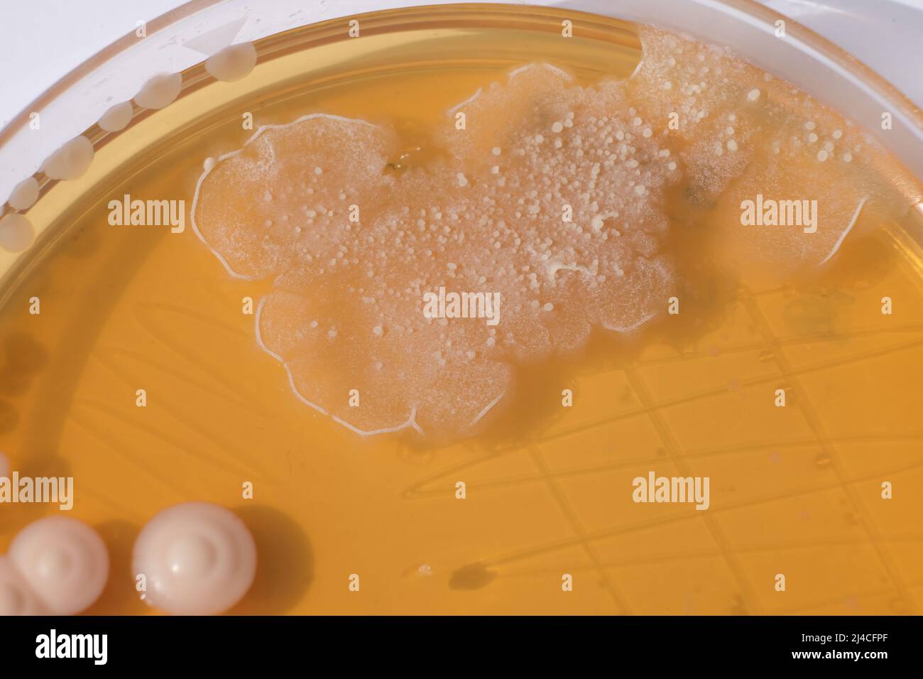 CLOSEUP PHOTO OF BACTERIA AND FUNGI GRWOTH ON AGAR MEDIA IN A PLASTIC ...