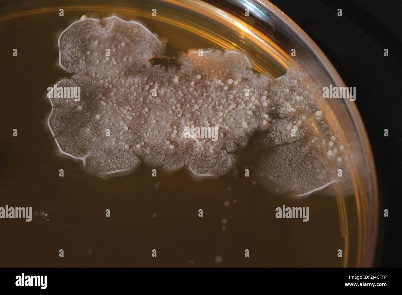 Actinomyces Colony Morphology