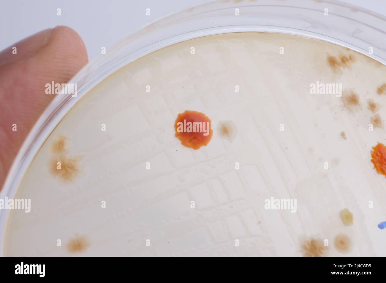 CLOSEUP PHOTO OF BACTERIA AND FUNGI GRWOTH ON AGAR MEDIA IN A PLASTIC ...