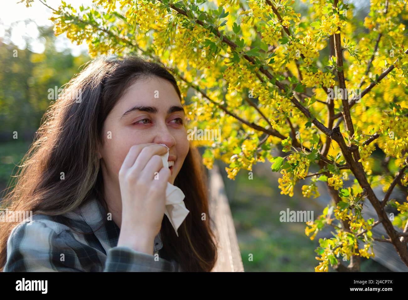 A young pretty woman is suffering from allergies. Red eyes and running snot. The concept of ...