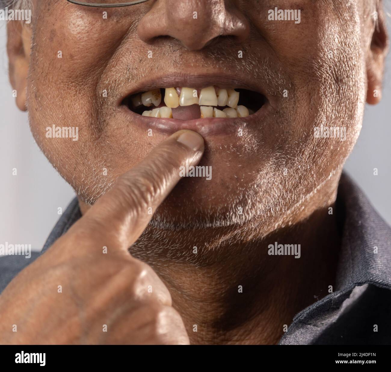 Close up of missing teeth of an old Indian male Stock Photo - Alamy