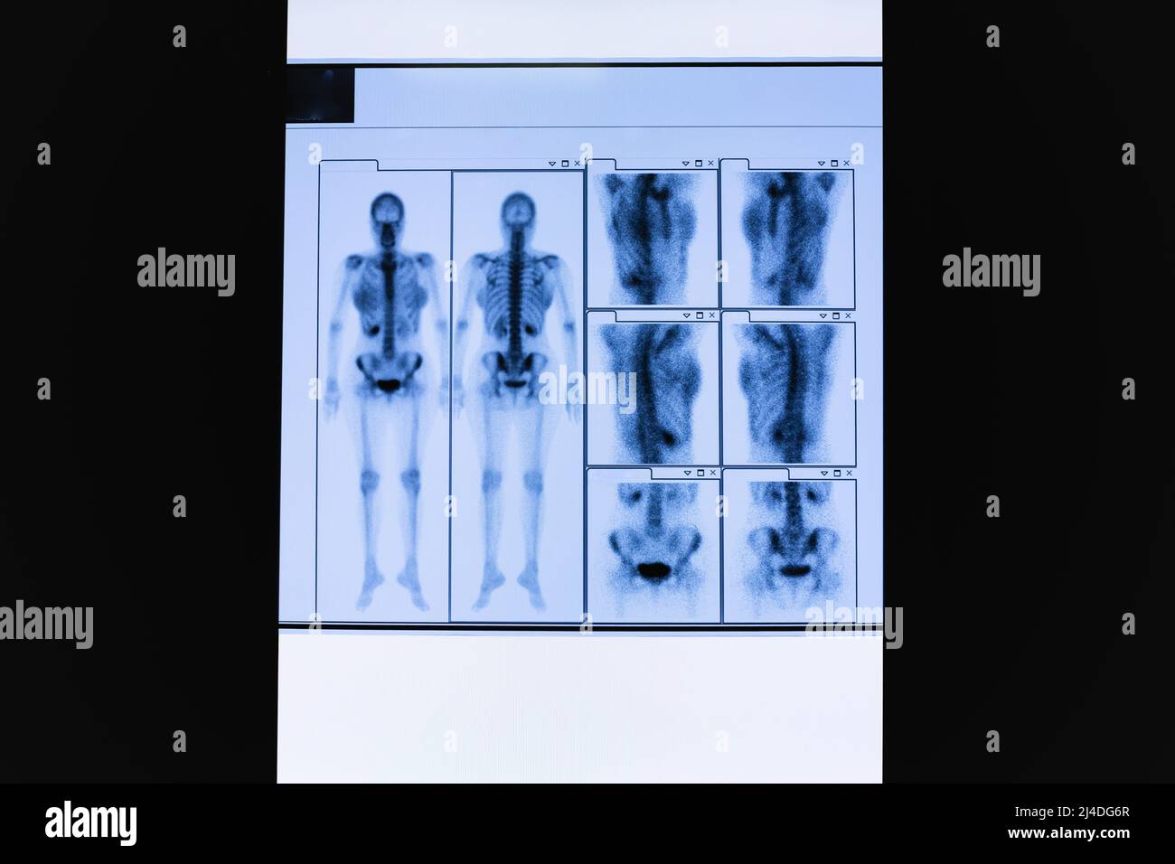Set of TC scan of female whole body skeleton and internal organs Stock ...