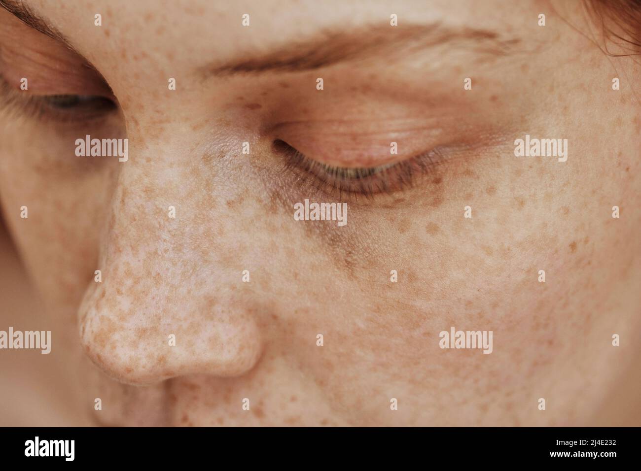 Macro shot of face with freckles of young natural woman with no-makeup ...