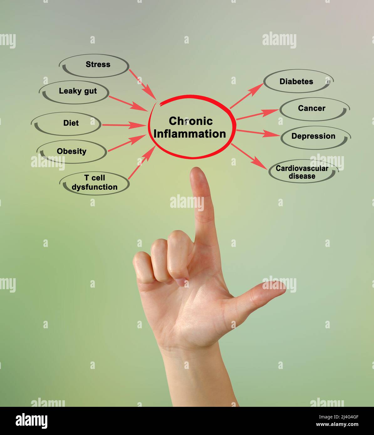 Causes and effects of Chronic Inflammation Stock Photo - Alamy