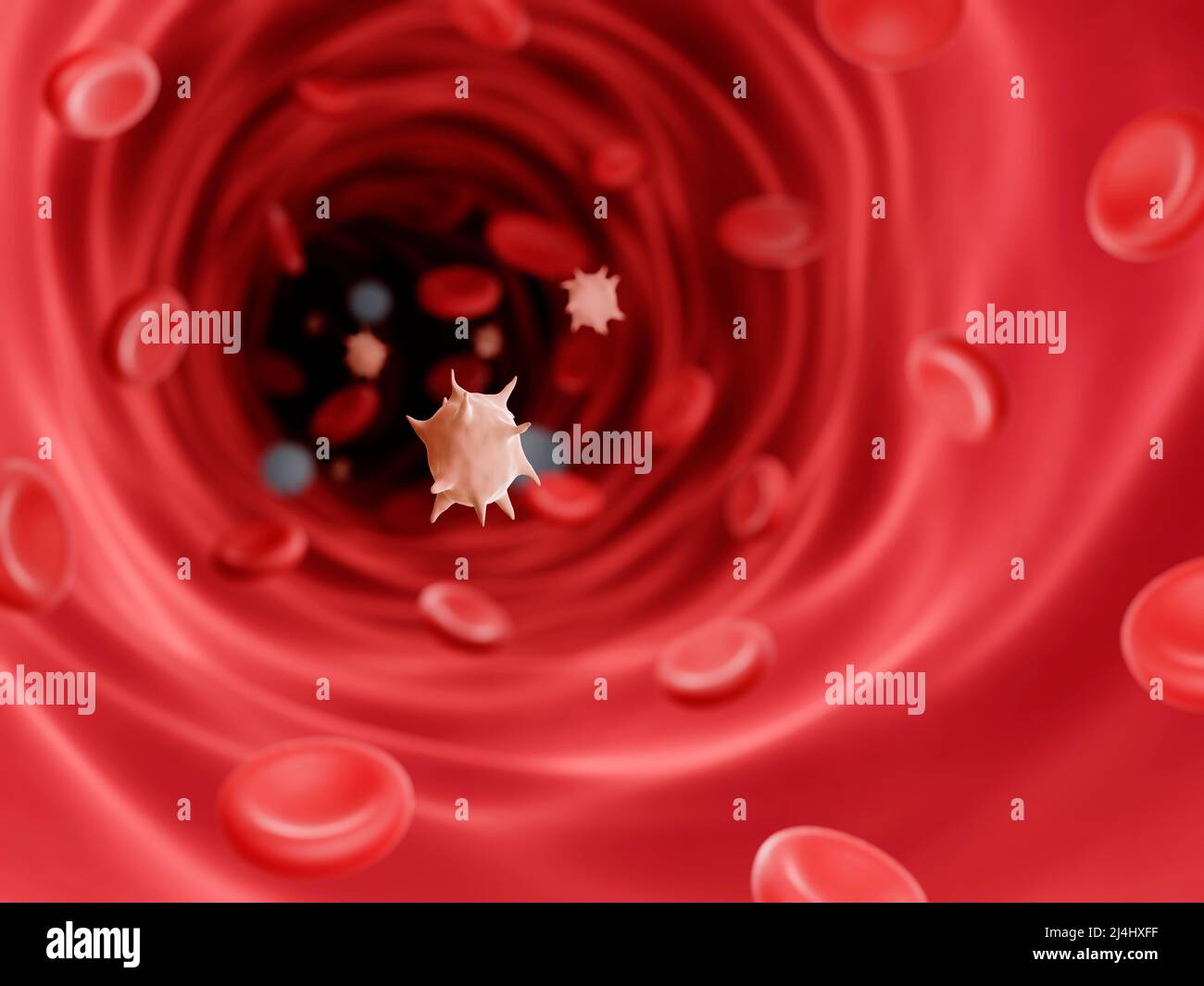 Thrombocytopenic hi-res stock photography and images - Alamy