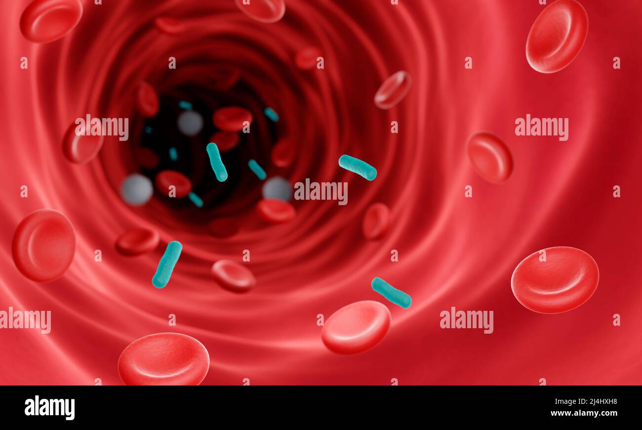 Bacterial sepsis, illustration Stock Photo - Alamy