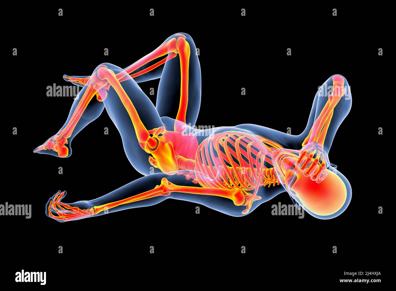 Man in pain, illustration Stock Photo - Alamy