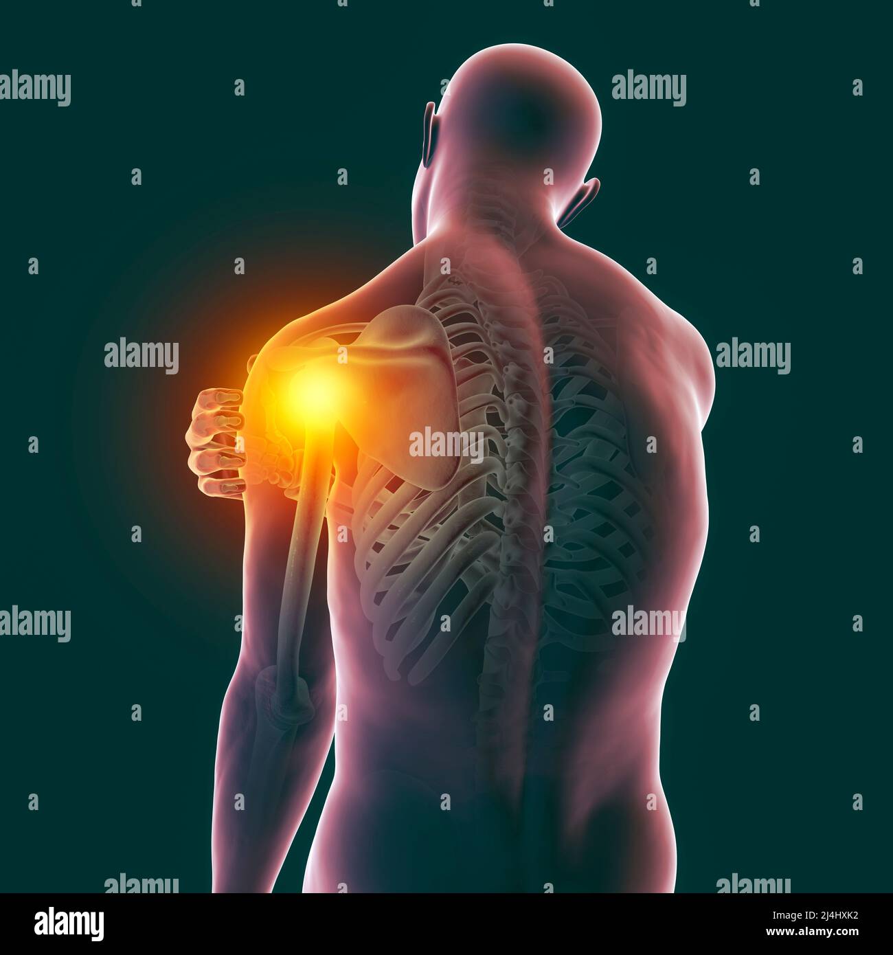 Painful shoulder, illustration Stock Photo - Alamy