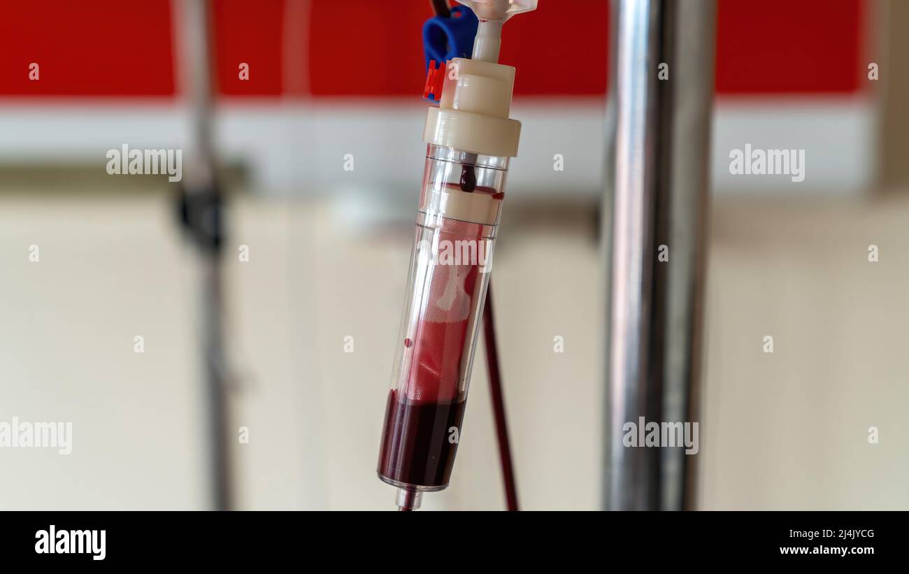 Platelet Transfusion Tubing