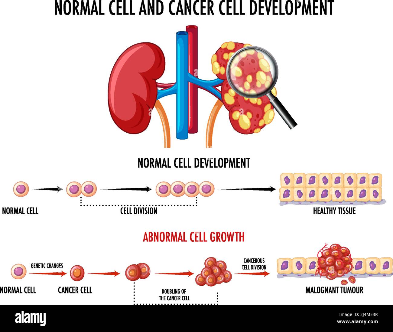 Diagram showing normal and cancer cell illustration Stock Vector Image ...