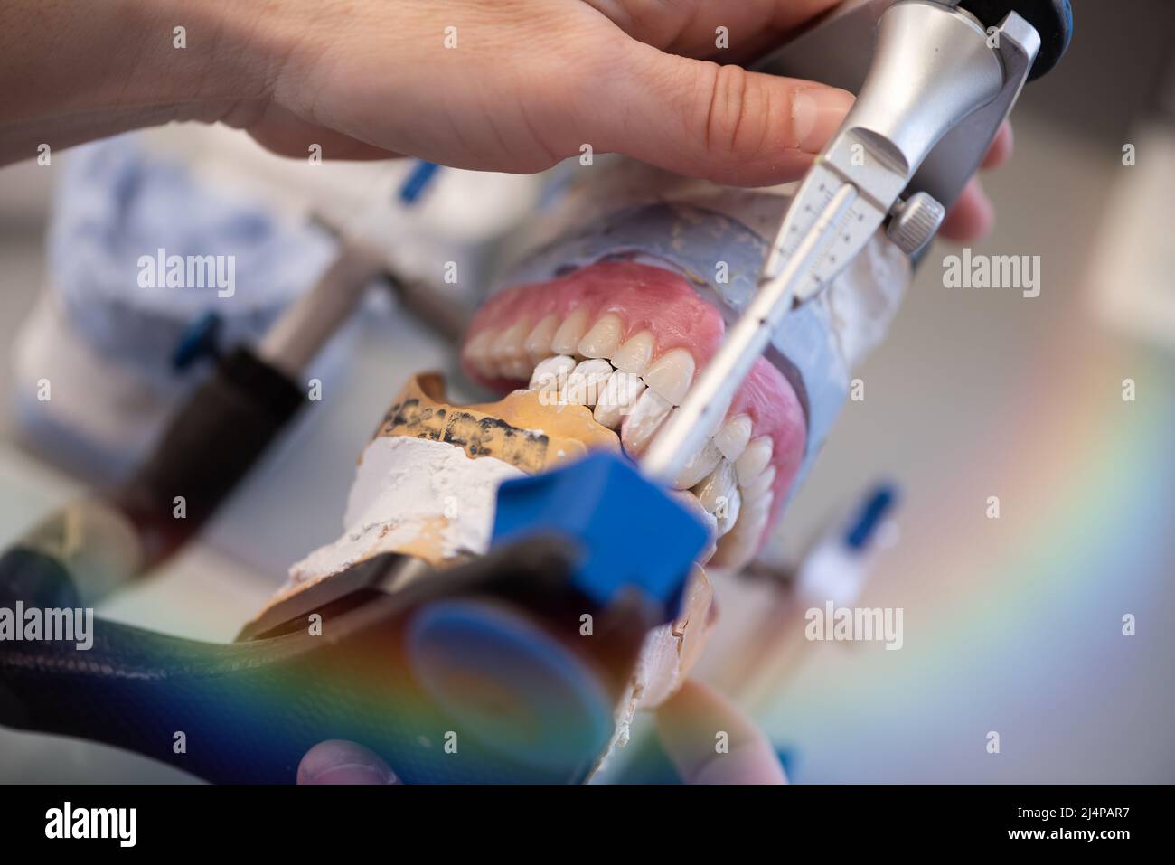 Dental prosthesis, dentures, prosthetics work. A study and a table with ...