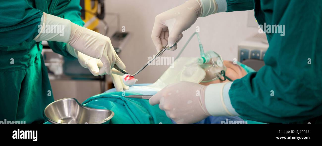 Closeup hands of team doctor and surgeon doing surgery with patient in ...