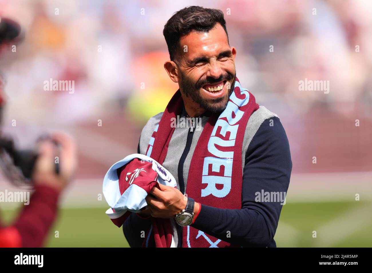 Carlos Tevez Scar Chest