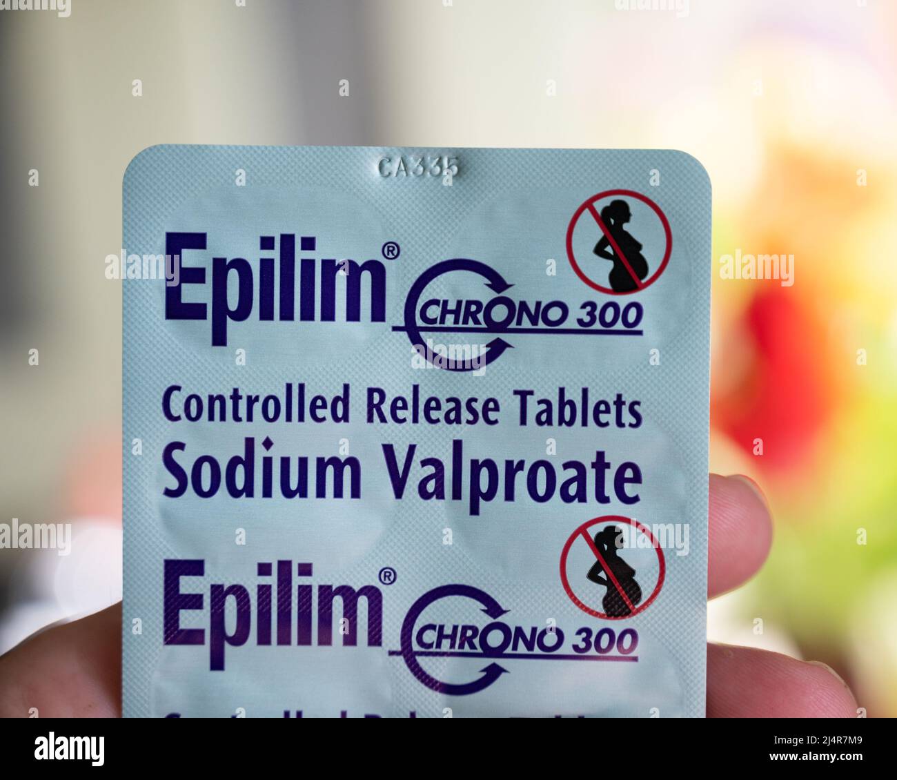 Sodium valproate has caused physical and learning difficulties in ...