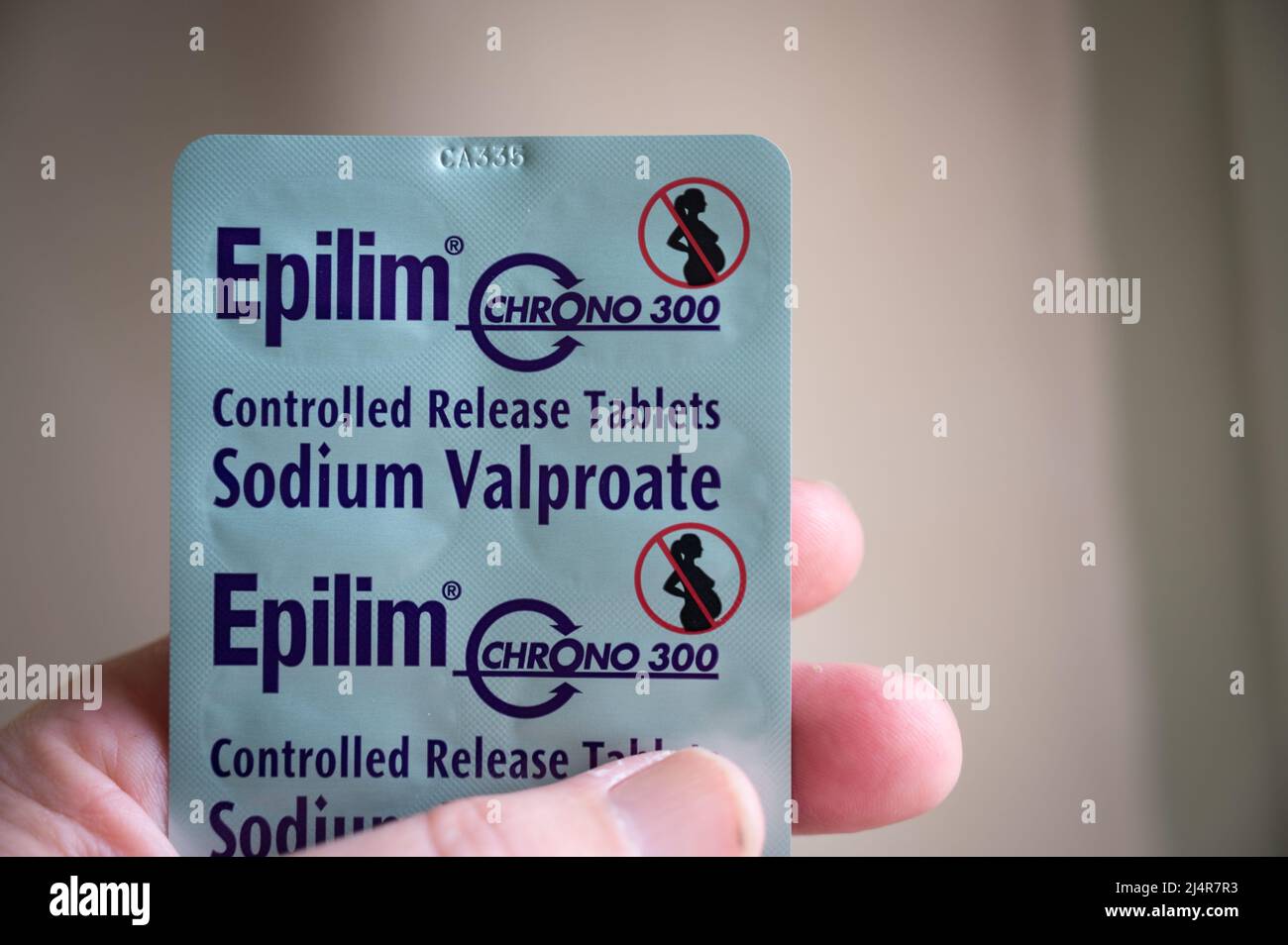 Sodium valproate has caused physical and learning difficulties in ...