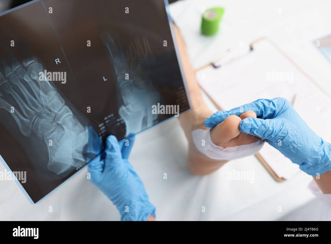 Doctor holds x-ray with dislocated leg of patient lying on table Stock ...
