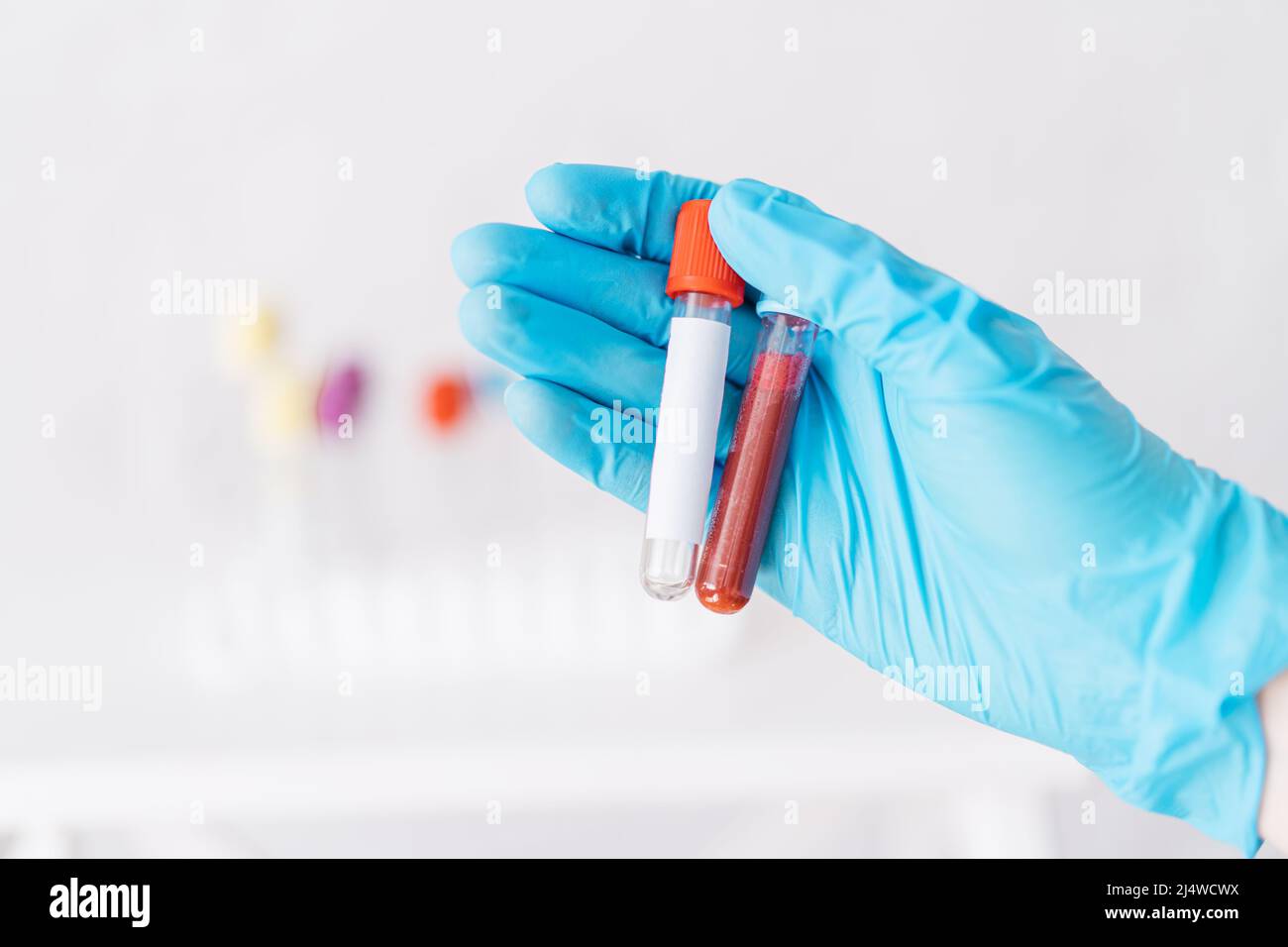 Hand holding two empty test tubes against the background of vials Stock ...