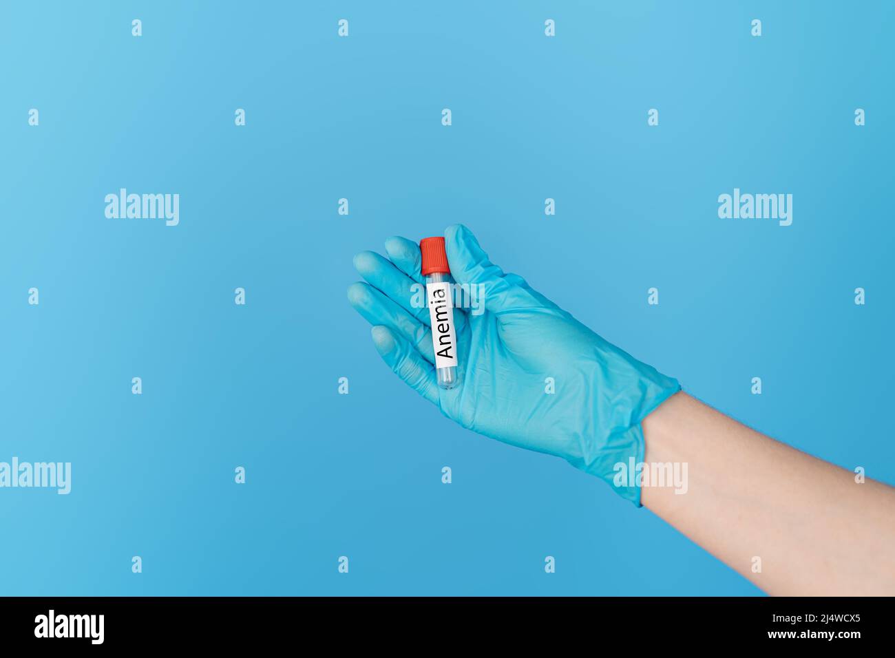 Hand holding test tube with the inscription anemia Stock Photo - Alamy