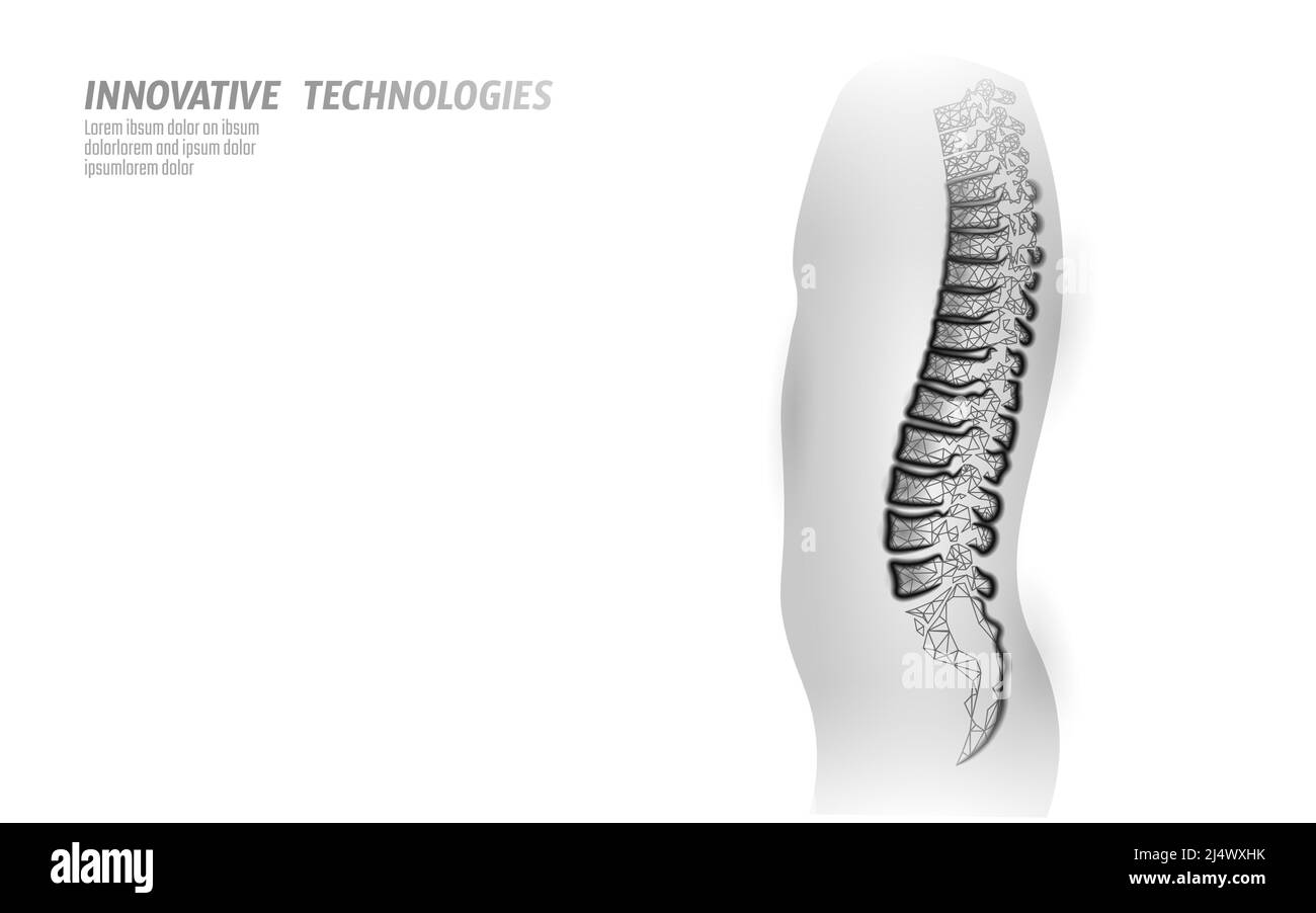 3D backbone low poly. Physical therapy manual osteopathic massage. Cure ...