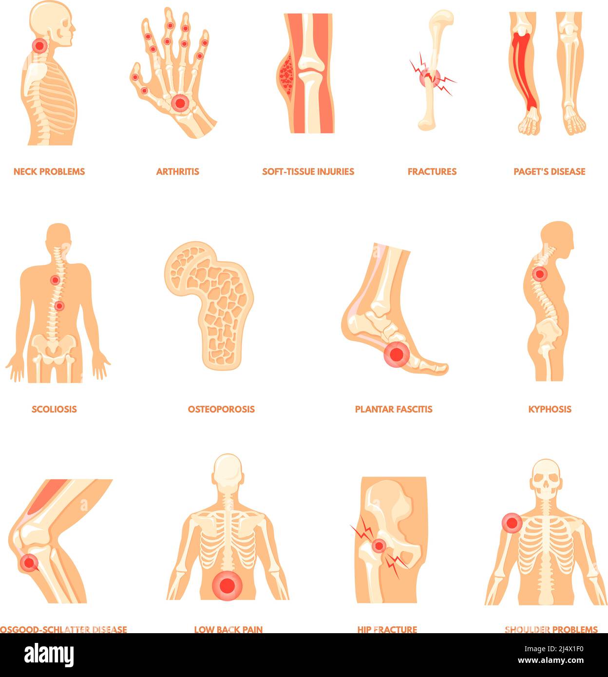 Body orthopedic problem. Human bone injury, anatomy health diseases ...