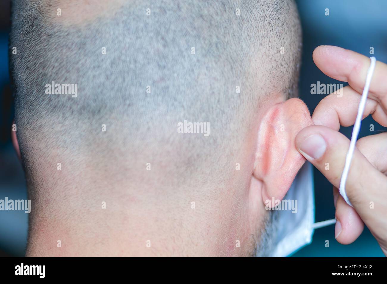 Skin irritation hi-res stock photography and images - Alamy