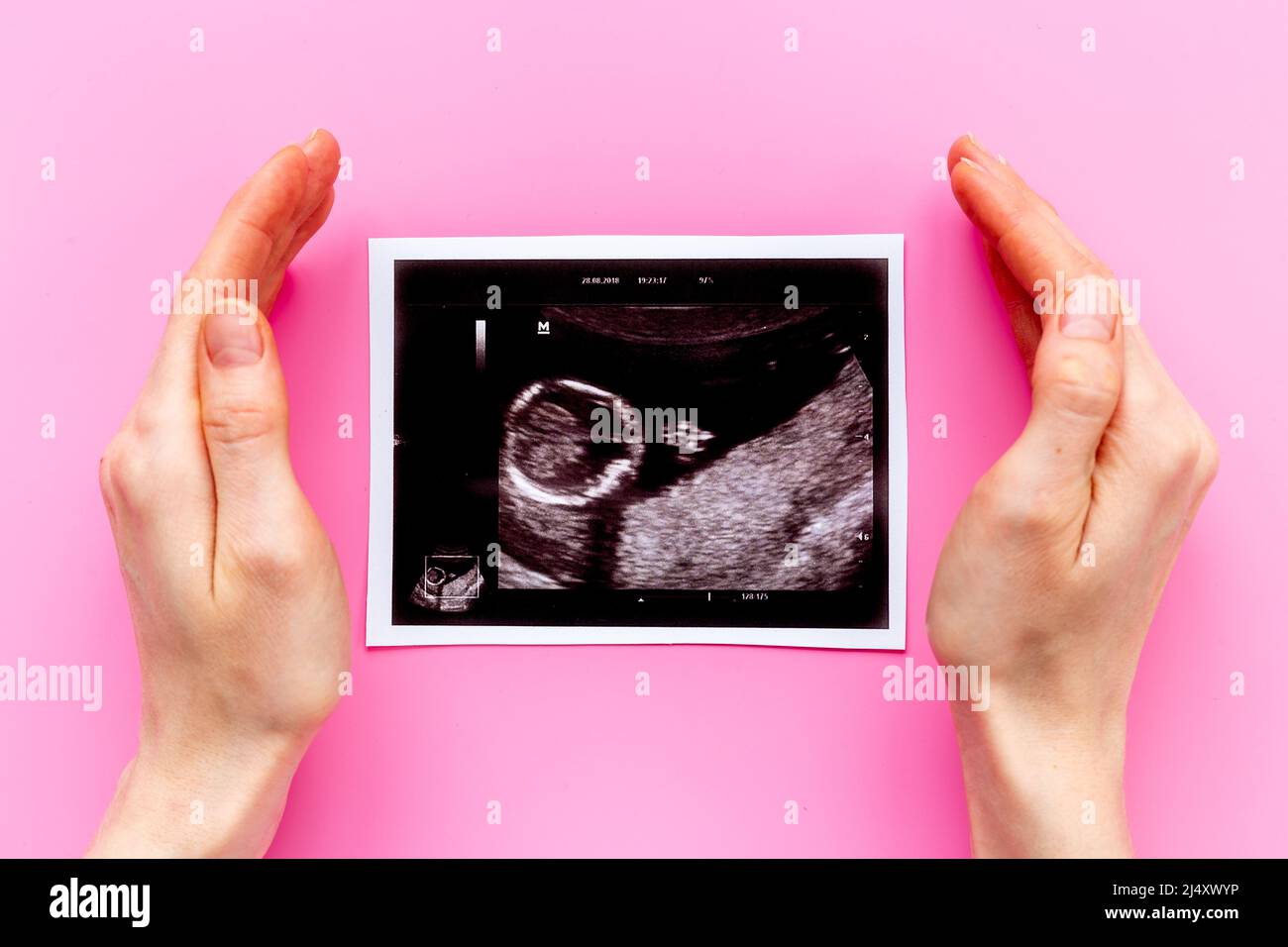 Womans hands holding ultrasound scan of unborn baby. Pregnancy ...