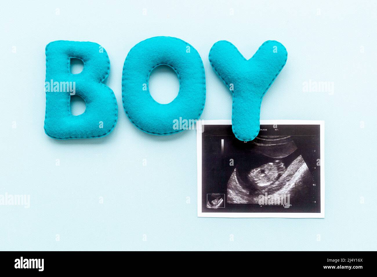 Ultrasound scan of unborn baby with letters boy Stock Photo - Alamy
