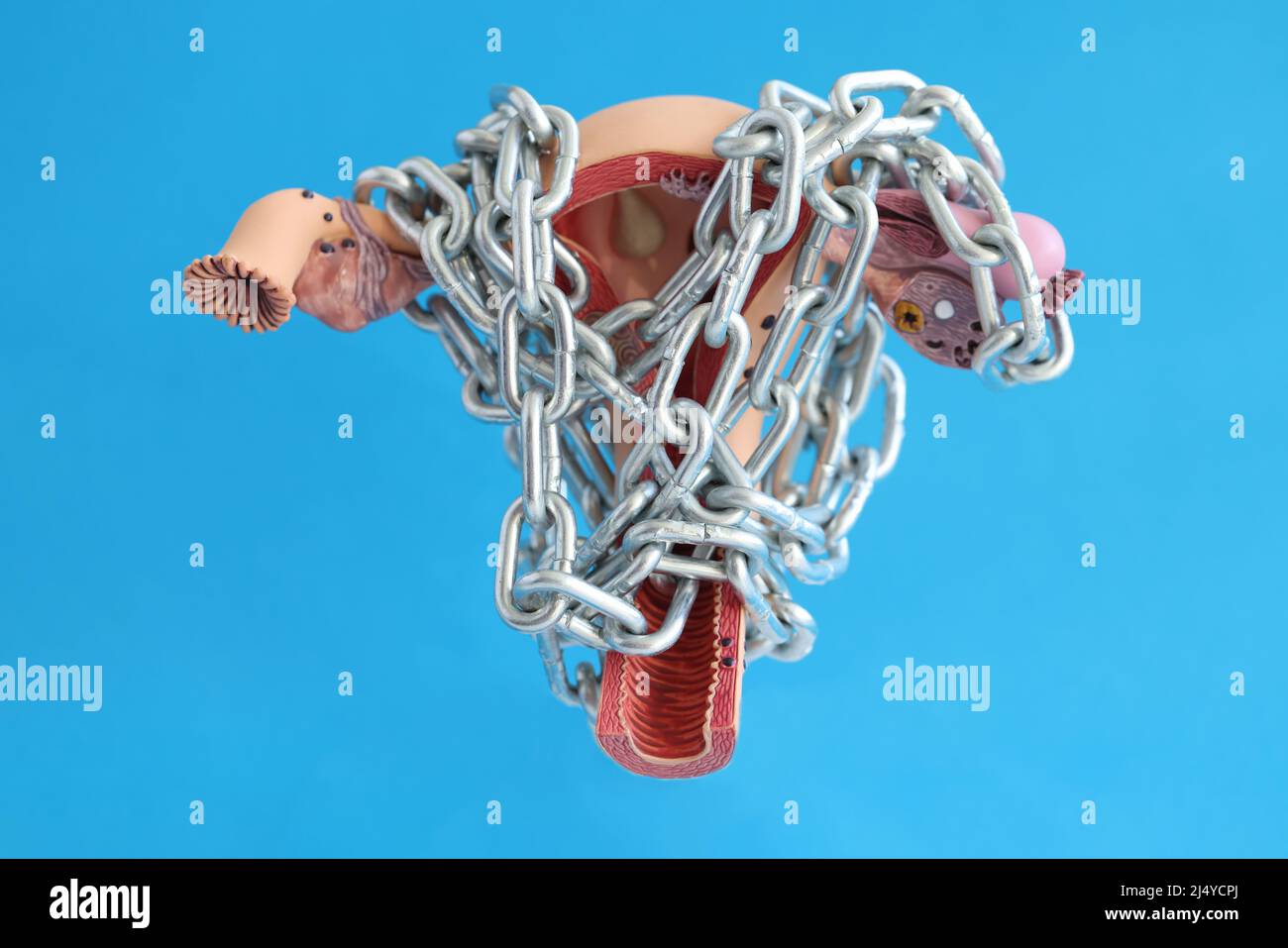 Medical concept of uterine and abdominal pain with pain chain Stock ...