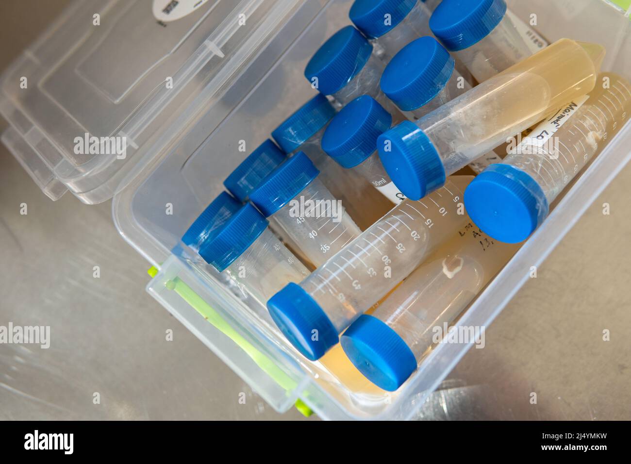 centrifuge tube with a nutrient medium for the development of mycelium ...