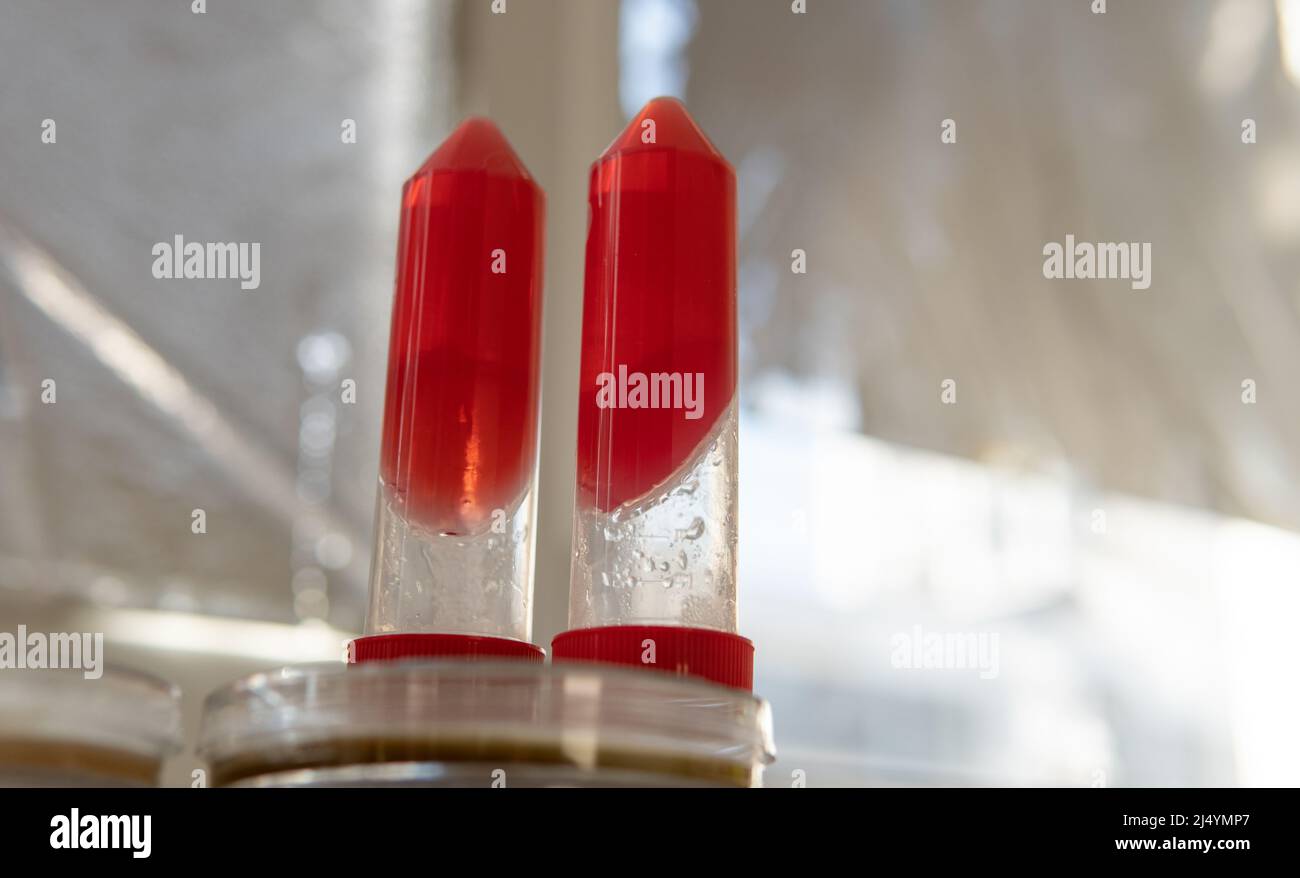 slants and petri dishes with agar for research. Mycology and ...