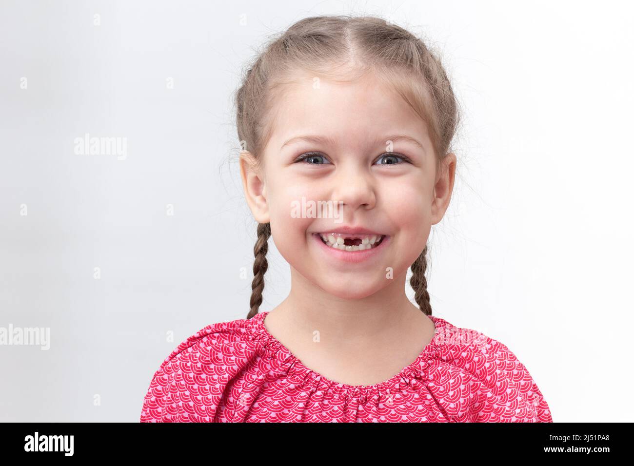 Smiling child without upper central teeth on white background caucasian ...
