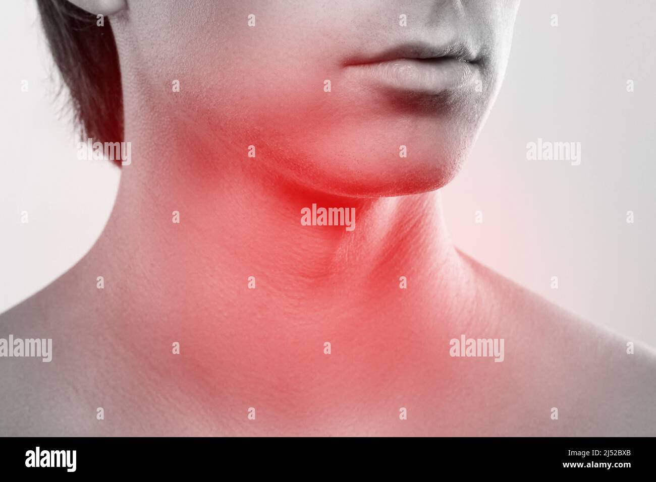 Closeup of male neck with with a symptoms of sore throat Stock Photo ...
