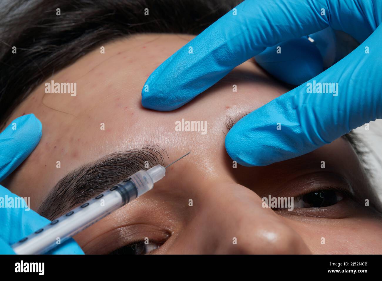 Men's cosmetology. Beautician injects a botulinum toxin into a man's ...