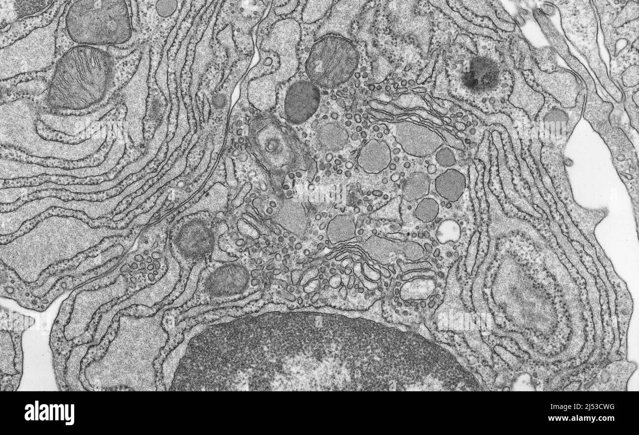 Protein synthesis, TEM Stock Photo - Alamy