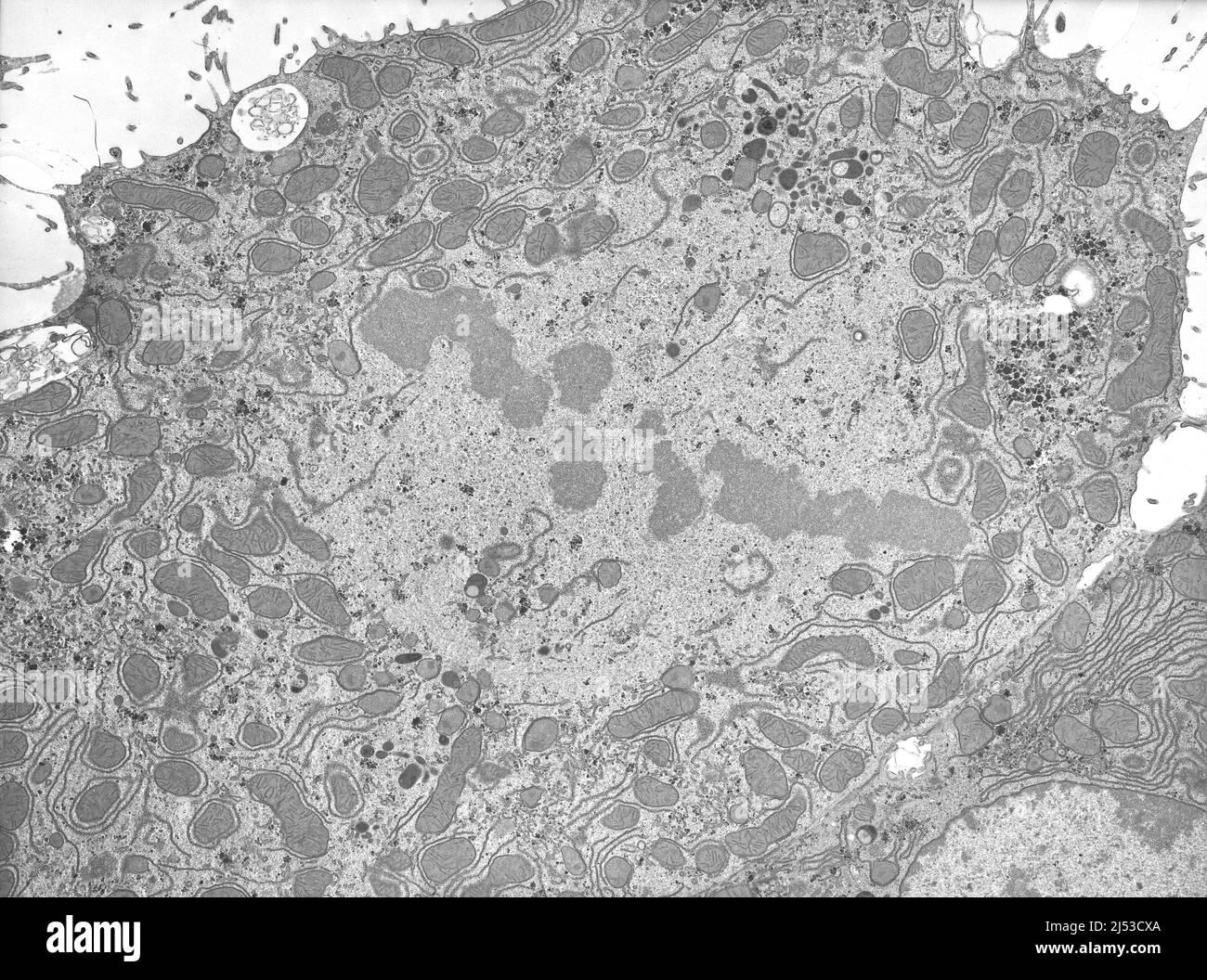 Dividing cell, TEM Stock Photo - Alamy