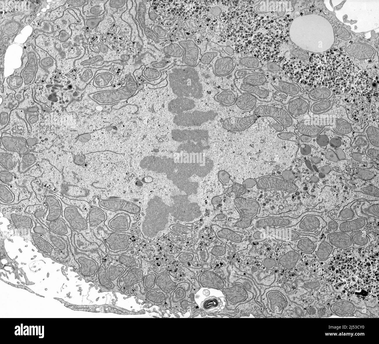 Dividing cell, TEM Stock Photo - Alamy