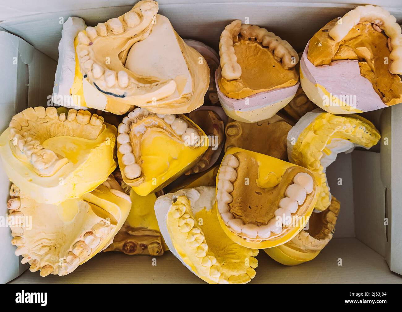 Layouts of human jaws in the dentist's office Stock Photo - Alamy