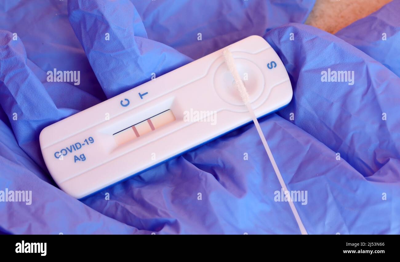 rapid test to diagnose coronavirus positivity with nasal swab and the ...