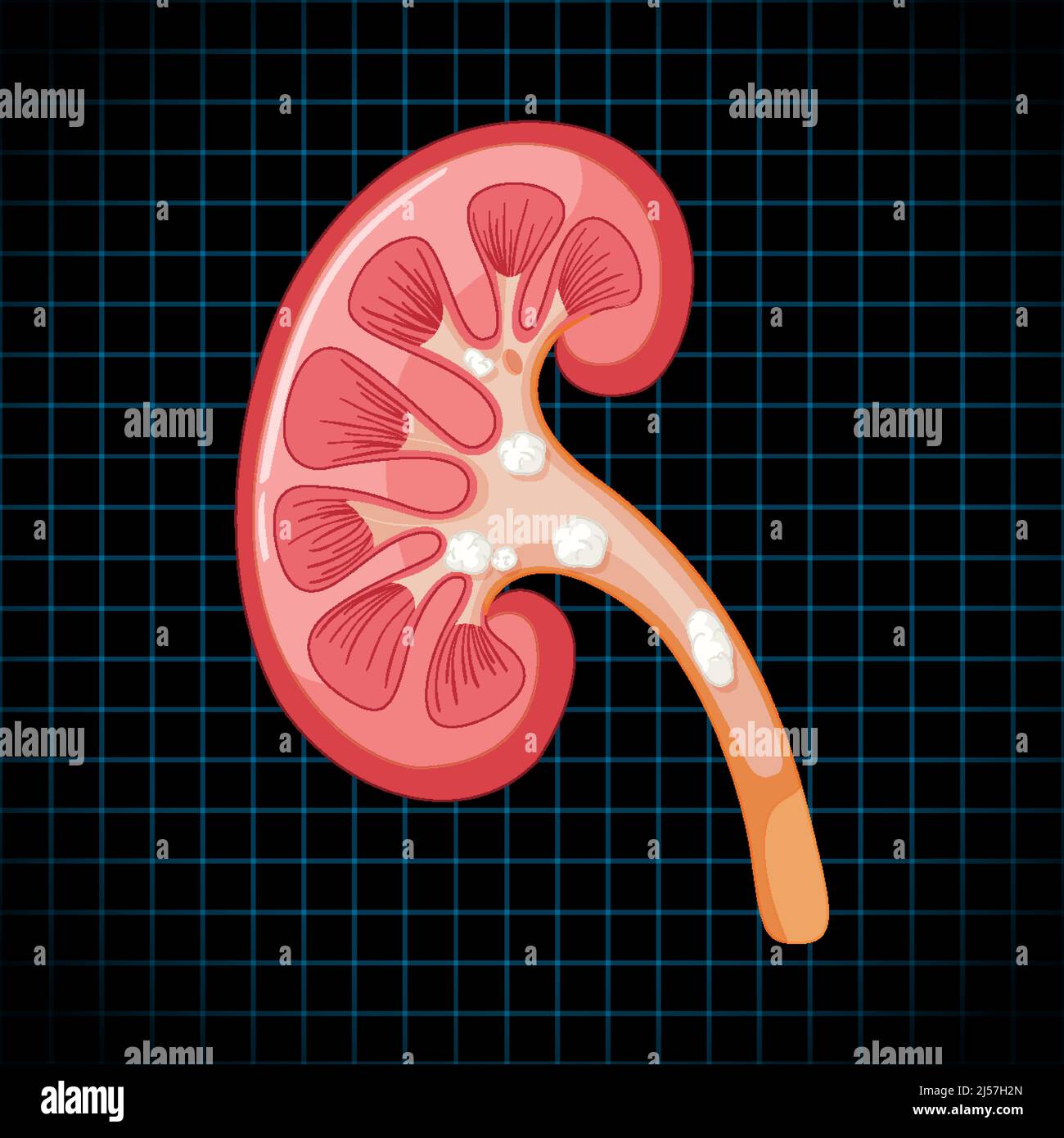 Human internal organ with kidney illustration Stock Vector Image & Art ...