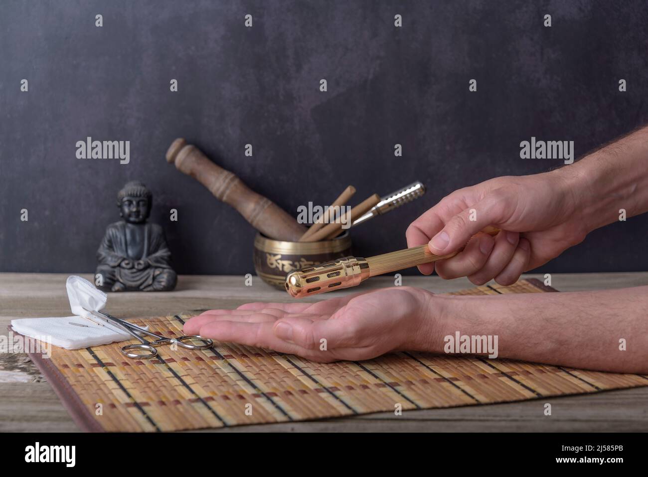 Moxibustion therapy - Traditional Chinese Medicine. Placement of the ...