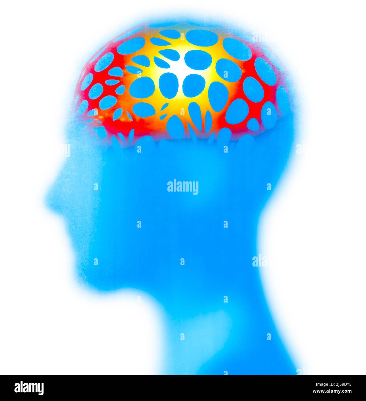 Side view of man with headache, brain pain, symptoms. Vertigo and drop ...