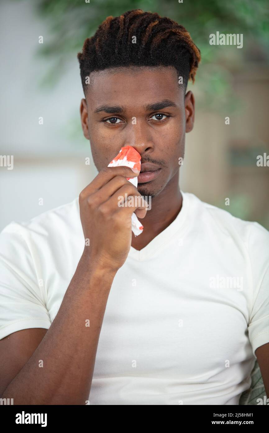 Nose bleed first aid hi-res stock photography and images - Alamy