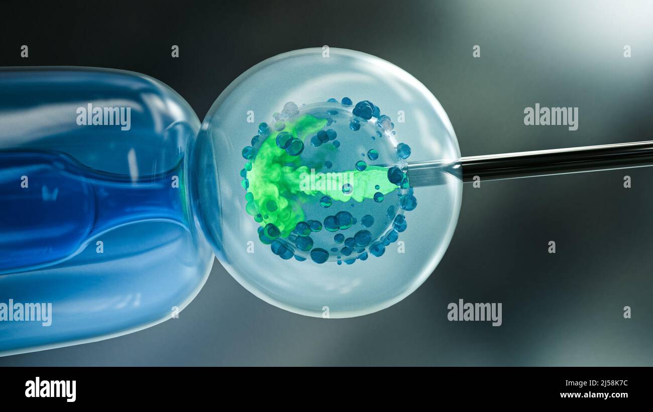 IVF (in vitro fertilization) or fertilization of the female egg with a ...