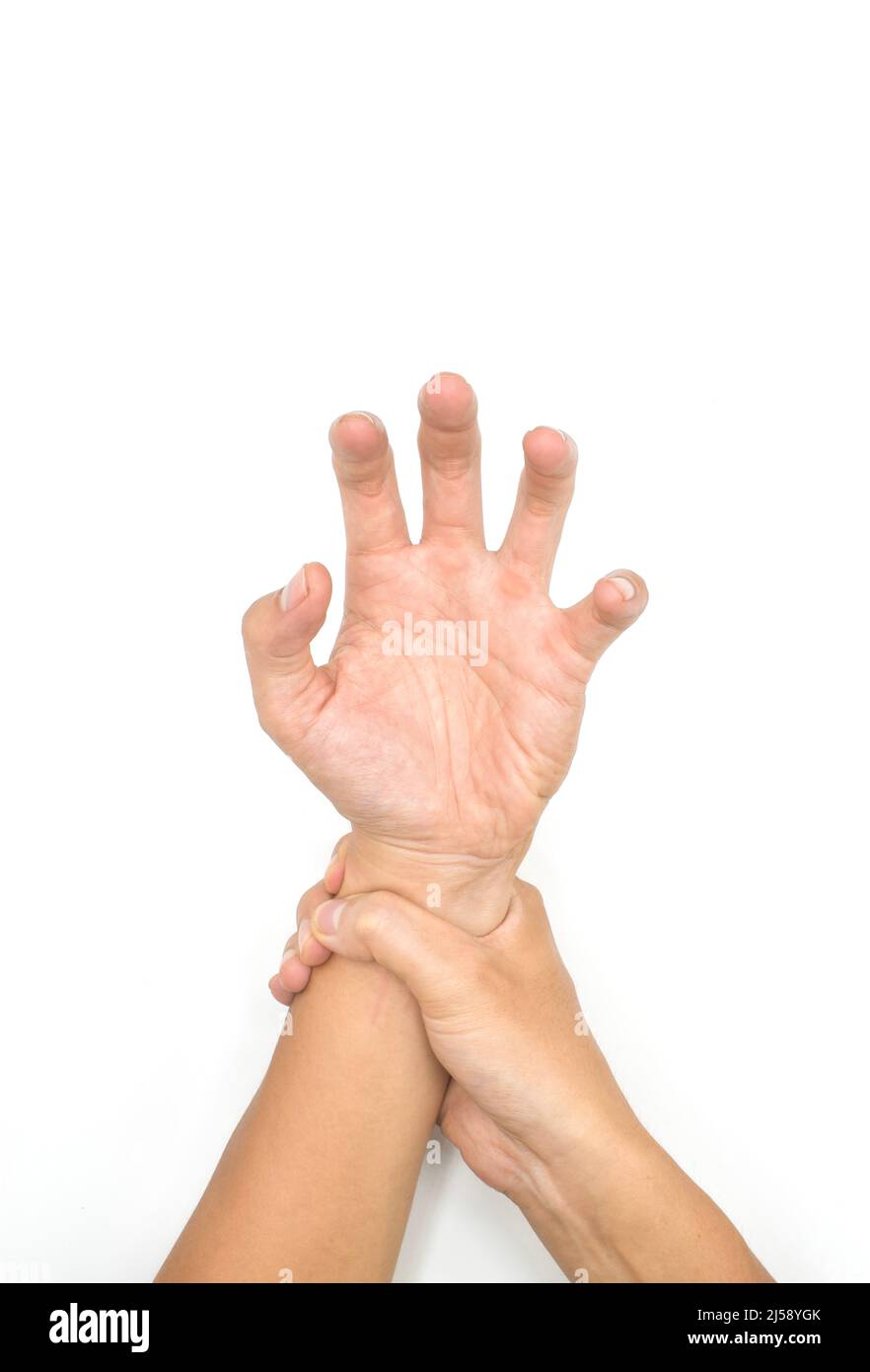 Volkmann contracture in upper limb of Asian young man. It is a ...