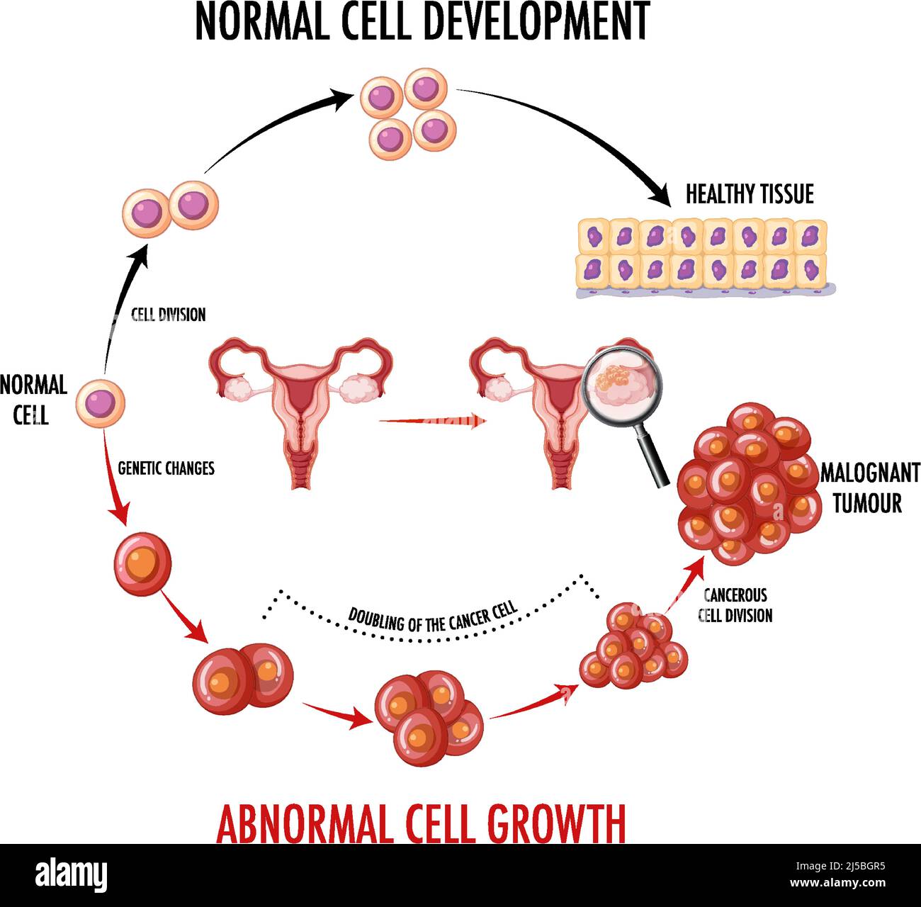 Diagram showing cancer development process illustration Stock Vector ...