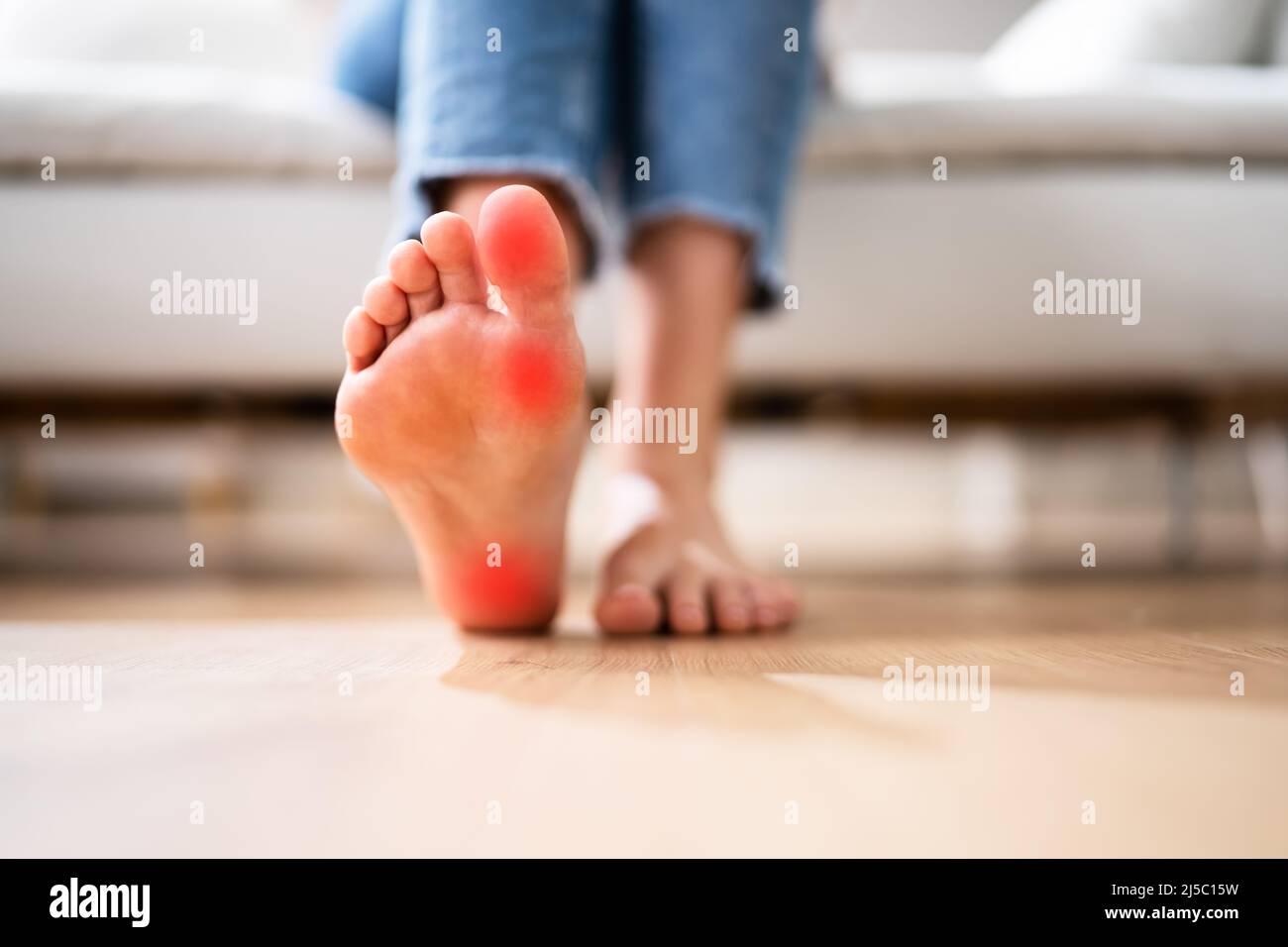 Foot Heel Pain And Callus Care Closeup. Female Leg Health Stock Photo ...