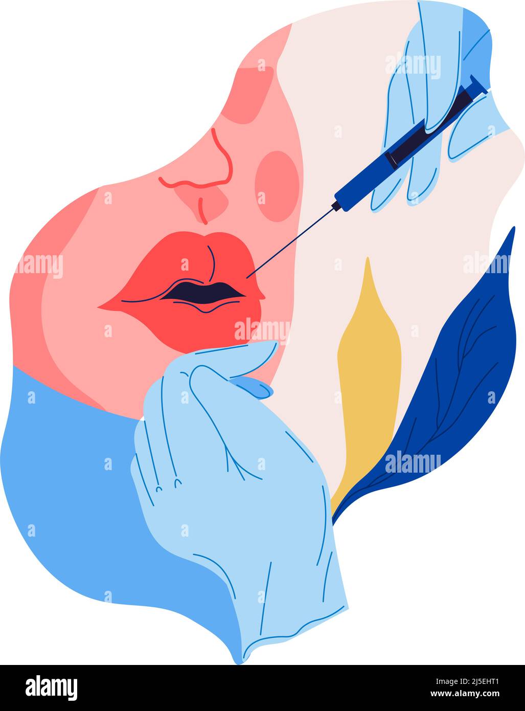 Reshaping and augmentation of lips, botox injection Stock Vector Image ...